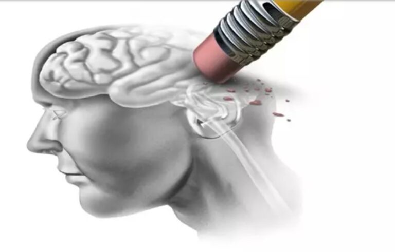 Desarrollo del Alzheimer - Fort-Da Centro Médico ODALY